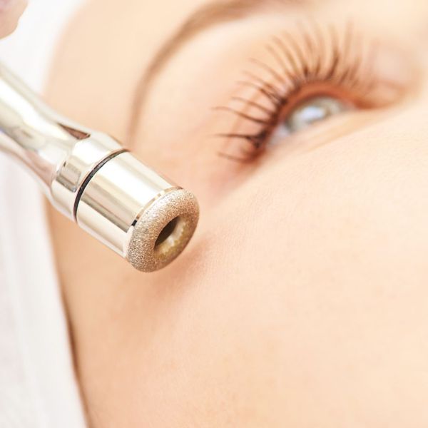 What Does Microdermabrasion Do Elevate Med Spa And Lounge